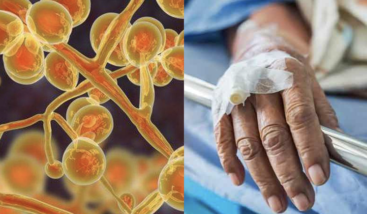 ¿Qué es el Candida auris? Conoce los síntomas y cómo prevenir este ...