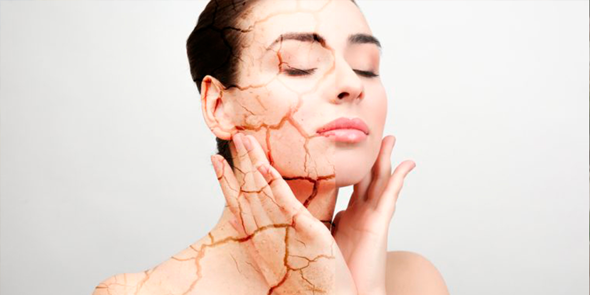 Aprende a cuidar e hidratar la piel seca | El Popular