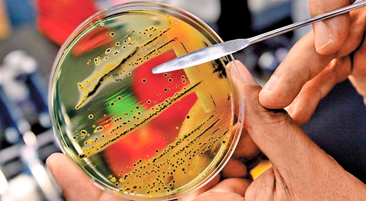 Estados Unidos reporta brote de salmonella en 8 estados tras contacto con pájaros silvestres ...