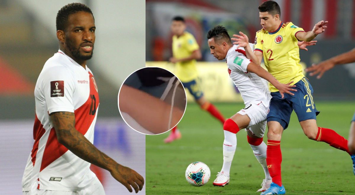 Jefferson Farfán Instagram Sorprende Con Imagen De Su Rodilla En El