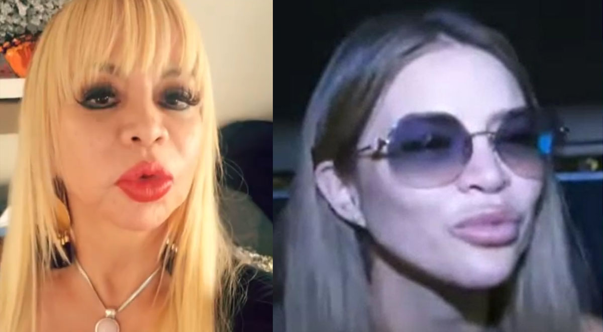 Susy Díaz le pide a Sheyla Rojas que no se preocupe por hinchazón en ...