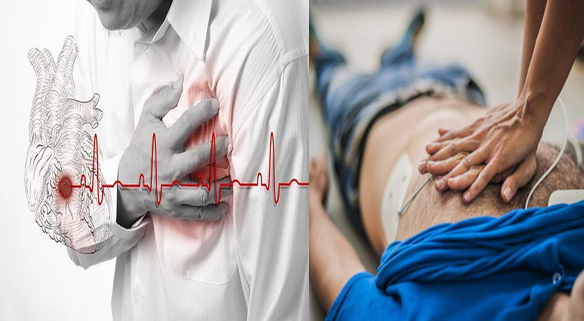 ¿Cuál es la diferencia entre un infarto y un paro cardíaco? | El Popular