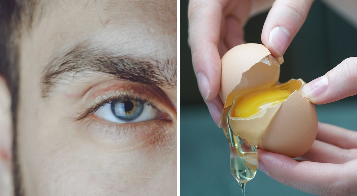 Mal del ojo: ¿qué significa las manchas y burbujas de agua que aparecen ...