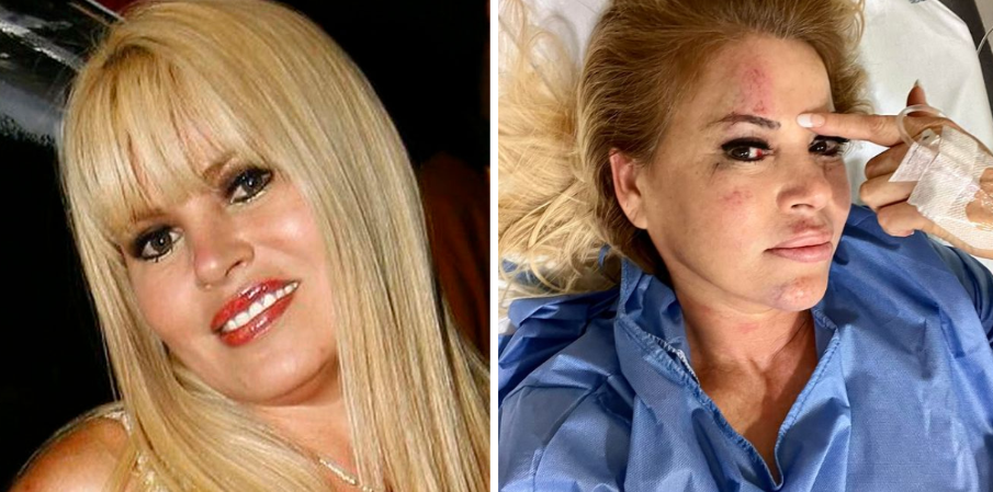 Daysi Ontaneda sufrió fuerte accidente al andar en scooter: "El dolor ...