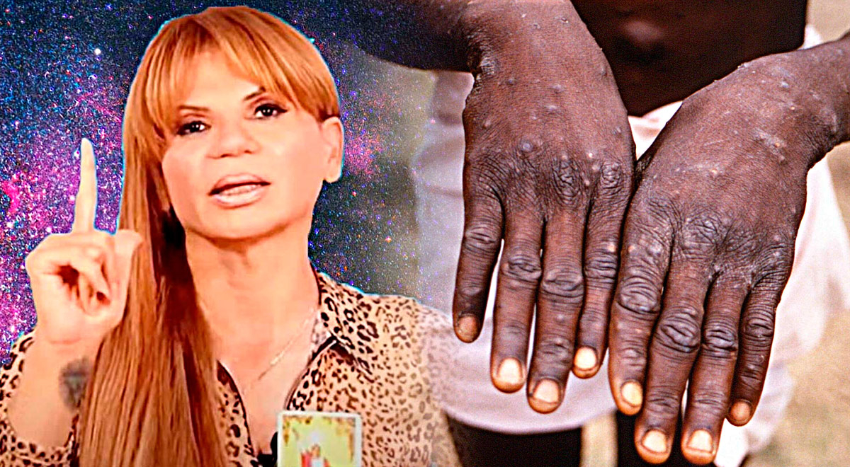 Mhoni Vidente lanza TERRORÍFICA predicción sobre la viruela del mono en ...