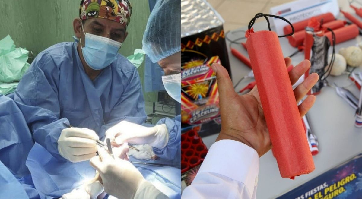 Tragedia en Ayacucho: niño de 11 años pierde dedos y un ojo por ...