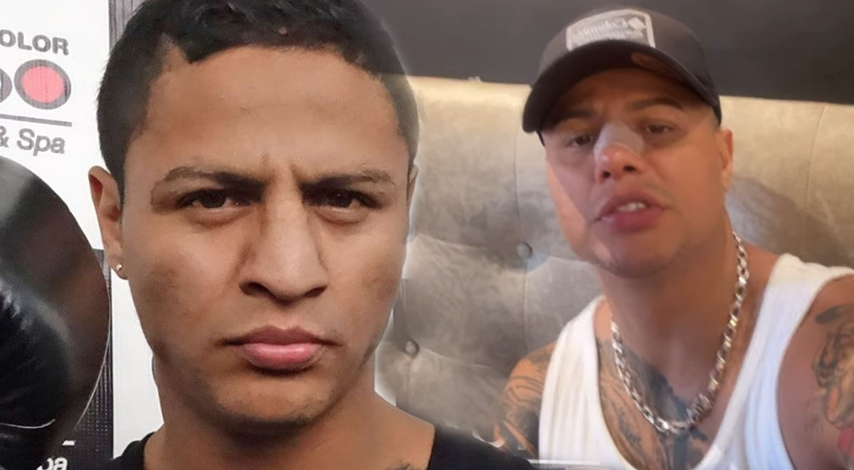 Jonathan Maicelo luce CAMBIO RADICAL tras operarse la nariz y usuarios ...